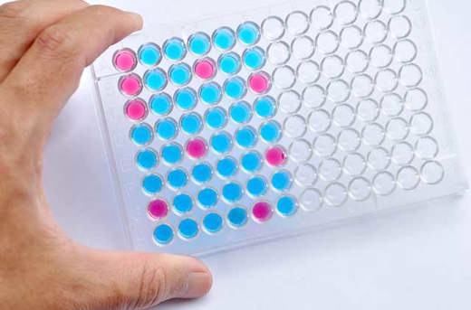 Immunology Laboratory - Oxford University Hospitals