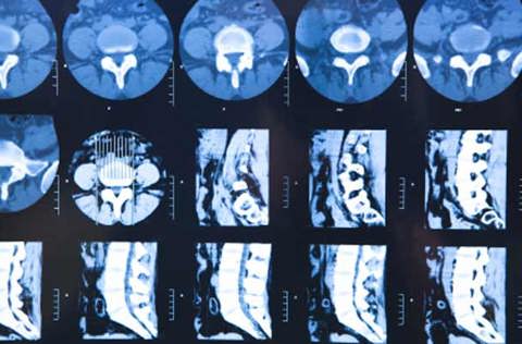 Oxford Spinal Surgery Unit - Oxford University Hospitals