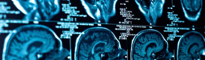 Neuroimmunology testing - Immunology Laboratory - Oxford University ...