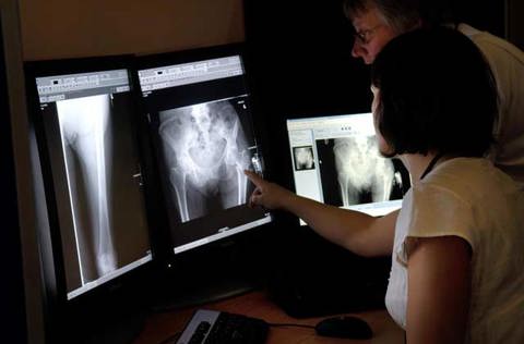 Bone Infection - Oxford University Hospitals