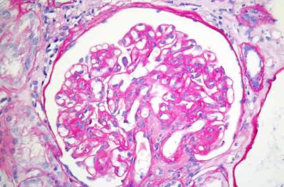 Cellular Pathology - Oxford University Hospitals