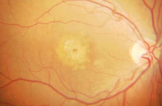 Oxford Eye Hospital - Oxford University Hospitals