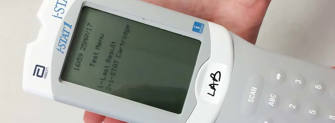 Point of care testing (PoCT) - Clinical Biochemistry - Oxford ...