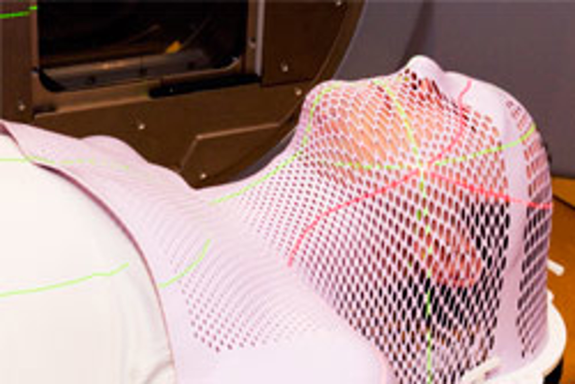 Pre-treatment - Cancer Services - Oxford University Hospitals